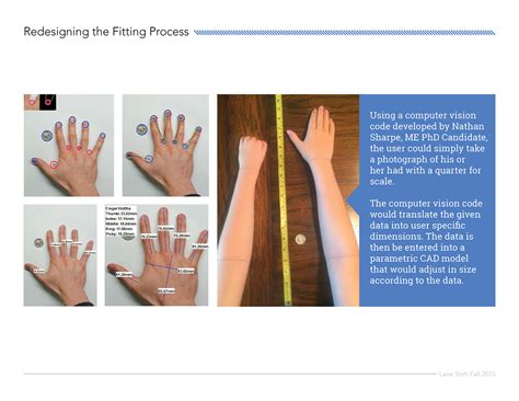 Prosthesis Design On Behance