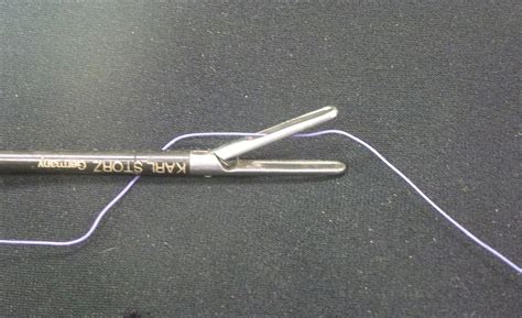 Endoloop Anwendung At Mae Burley Blog