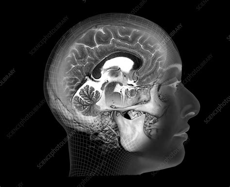 Human Brain Mri Scan Stock Image C0371634 Science Photo Library