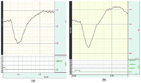 Electroretinogram Of Rat With The Simulated Retinal Download Scientific Diagram