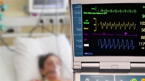 Cardiac Pacemaker Stock Footage Royalty Free Video Clips Storyblocks