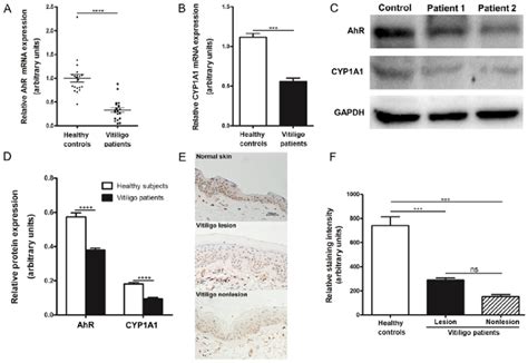 Ahr Expression Is Decreased In The Cd4 T Cells And Skin Of Patients