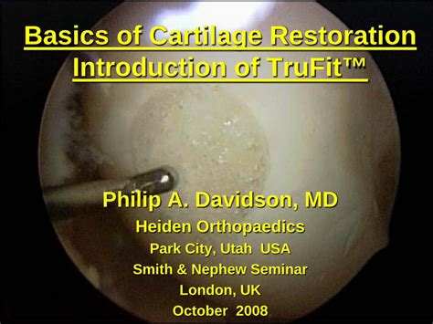 Pdf Basics Of Cartilage Restoration Introduction Of Trufit™ · Pdf