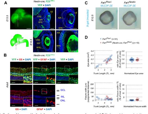 Figure 2 From Astrocyte Intrinsic And Extrinsic Fat1 Activities Regulate Astrocyte Development