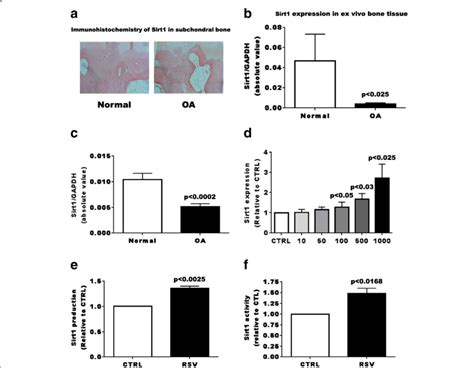 effect of resveratol rsv on sirtuin 1 sirt1 and p300 levels a