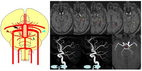 Neurovascular Evolution