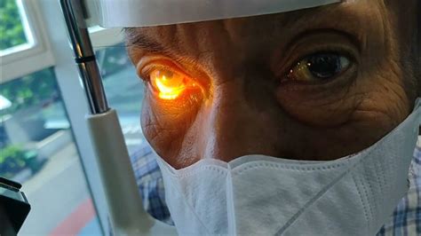 Iris Tremulans Youtube