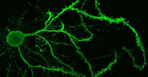 Salud Investigadores Españoles Determinan La Función De Un Receptor De Dopamina En El Control