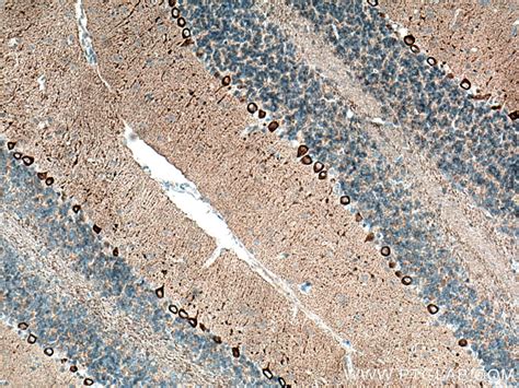 Alpha Synuclein Antibody 66412 1 Ig Proteintech