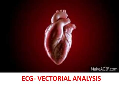 Ecg Vector Analysis Pptx