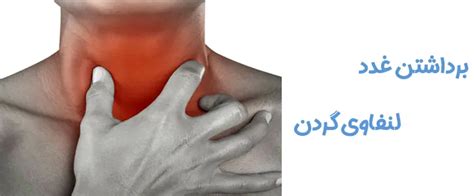 جراحی برداشتن غدد لنفاوی گردن لنفادنکتومی دکتر محمد سراج