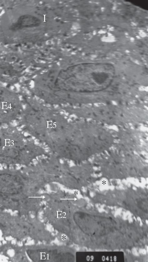 Oropharyngeal Basal And Suprabasal Cells E Show Dilatation Of