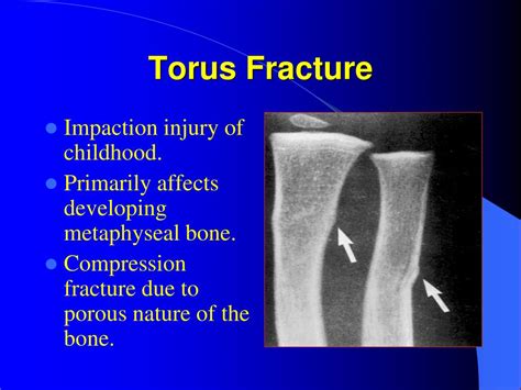 Torus Fracture Torus Fracture Right Arm 3 9 Yo Male Fell On His