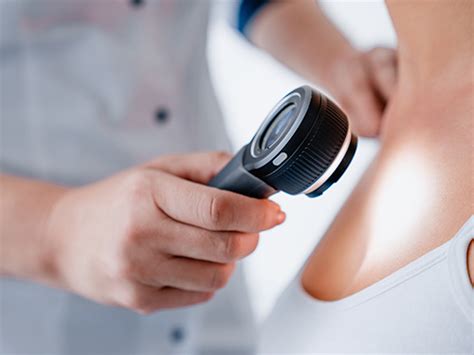 Mole Check And Skin Cancer Screening Derm Lab North Van