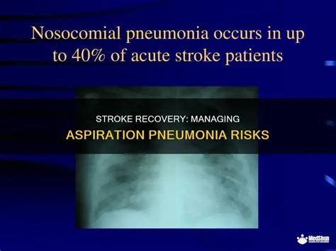 Stroke Recovery Managing Aspiration Pneumonia Risks Medshun