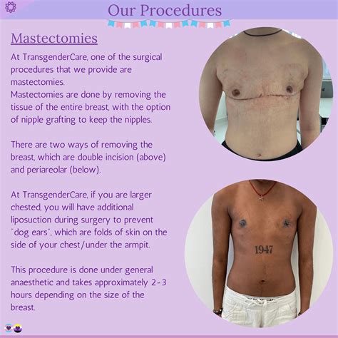 What Procedures Do We Do At Transgendercare We Do Many Different
