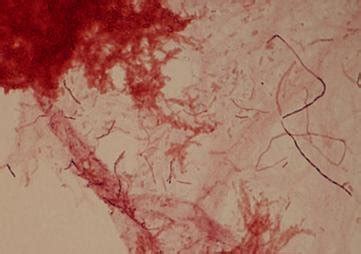 Biofilm Portions Under Optical Microscope At 100x Of Magnification The