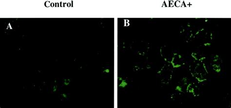Endothelial Cell Reactive Antibodies Binding To Cell Surface Antigens