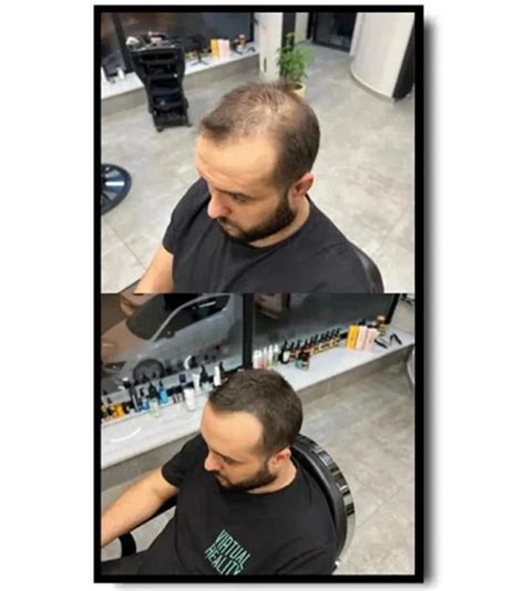 Batci Hair Concealer And Filling Cream 30ml 2τεμ ΔΩΡΟ ΧΤΕΝΑ Salontech