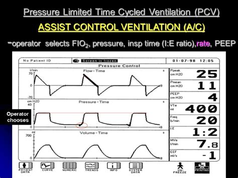 Basic Principles Of Ventilation In The Intensive Care
