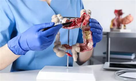 Sponge Assisted Laparoscopic Or Robotic Surgery Of Sigmoid Colon And Rectum Fails To Reduce