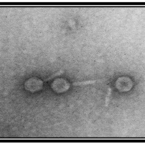 Transmission Electron Micrograph Of Salmonella Phage Ssbi34 The Phage Download Scientific
