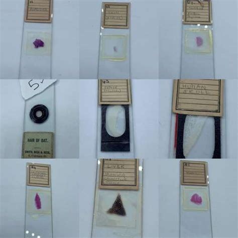 Antique Collection Of Human Pathology Microscope Slides