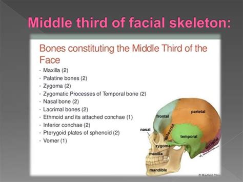 Naso Orbito Ethmoidal Fracture Pptx Death Injury Or Military