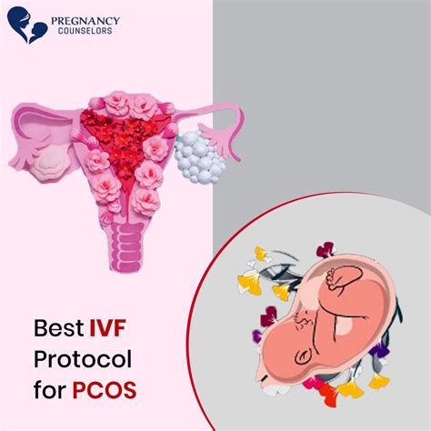 Best Ivf Protocol For Pcos Challenges And Best Approaches Pregnancy