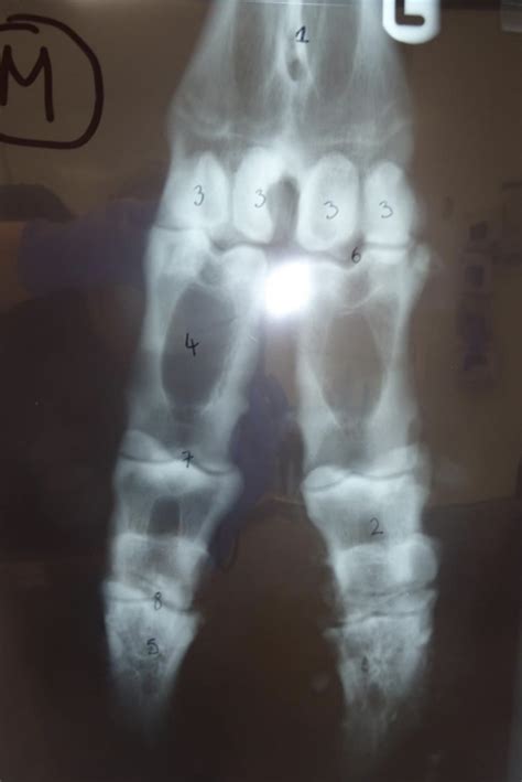 Diagram Of Bovine Metacarpal Radiograph Quizlet