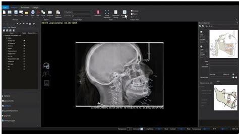 Logiciel Owandy Automatic Ceph Tracing Dentex