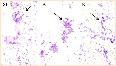 Lactobacillus Plantarum Gram Stain