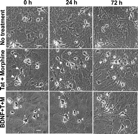 Representative Time Lapse Images Track Neuronal Fate Time Lapse Images