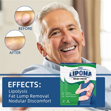 60pc Sumifun Lipoma Removal Patch Remove Fat Lump Nodular Sticker Anti