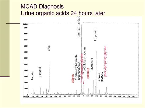 Ppt Newborn Screening For Mcadd Powerpoint Presentation Id4250360