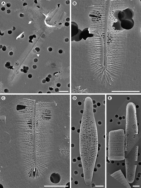 Rhabdonema Minutum Sem A Primary Longitudinal Perizonial Band Plpb
