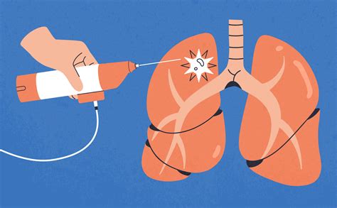 Micro Onde Mutuelle403