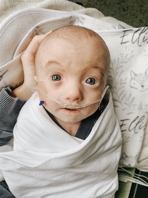 Impact Stories Ellis Bailey Speaks Abel Speaks