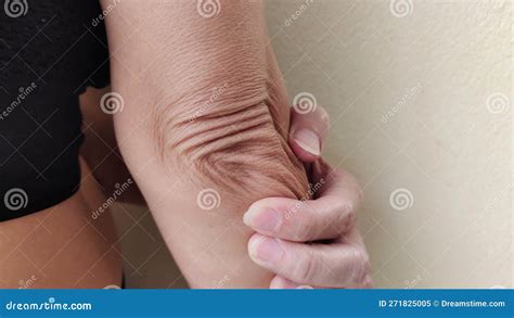 The Flabbiness And Wrinkles On The Arm Black Elbow Skin Stock Image Image Of Massage Beauty