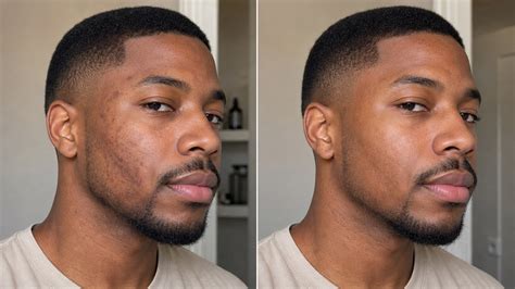 Skin Essence Clinic