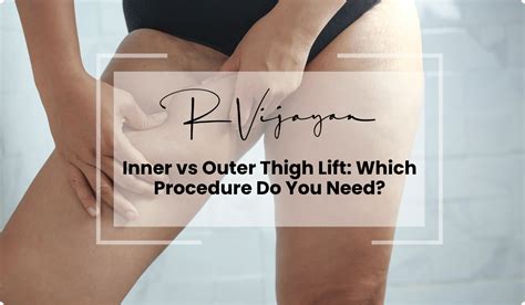 Inner Vs Outer Thigh Lift Which Procedure Do You Need Roshan Vijayan