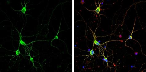 Dopamine Transporter Antibody Pa5 78382