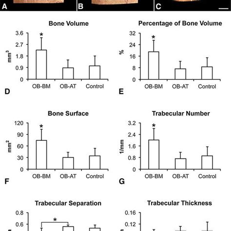 Three Dimensional Reconstructed Micro Ct Images And Morphometric