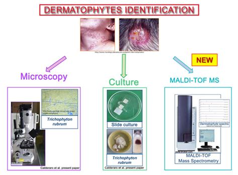 Ijms Free Full Text Identification Of Dermatophyte Species After Implementation Of The In