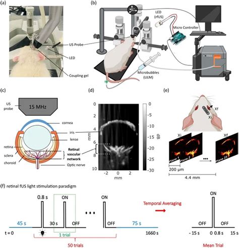 Ultrasound Localization Microscopy And Fus Imaging Set Up A Picture Download Scientific