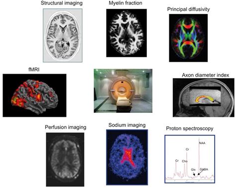 Macroscopic Measurement Of Microscopic Brain Properties This Simple
