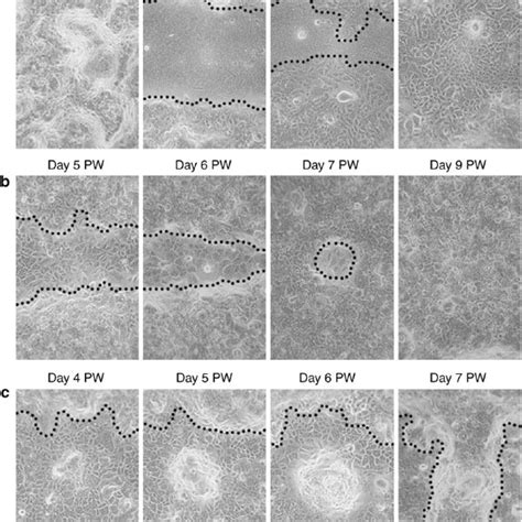 Transwell Organotypic Murine Epidermis Display A Differentiation