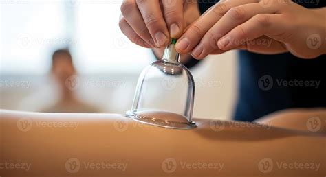 Cupping Therapy Hands Placing Glass Suction Cup On Human Back For