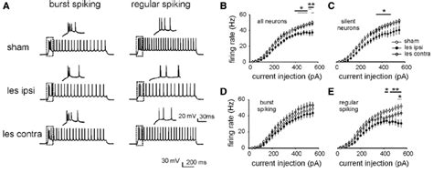 Cortex Specific Changes In Evoked Firing Of Layer 5 Pyramidal Cells Download Scientific Diagram