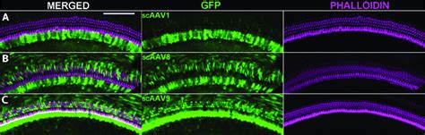 Self Complementary Aav Vectors Administered Via Round Window Membrane Download Scientific